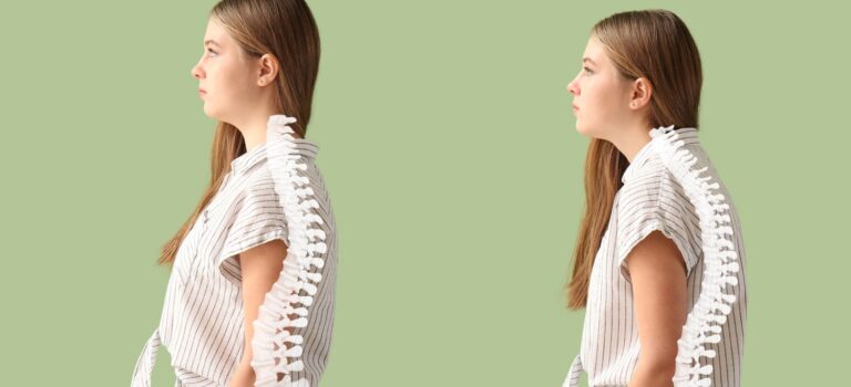 Cómo quitar la "chepa" con ejercicio físico - Traïnsplant